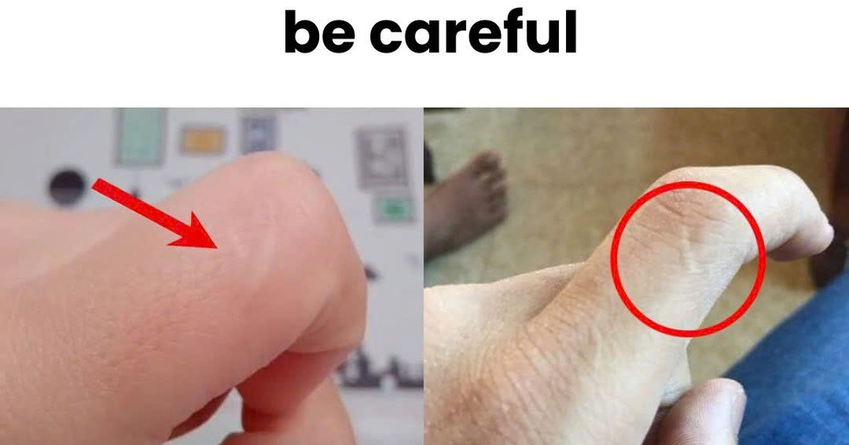 Anyone with this scar should be careful… - Yohanpost