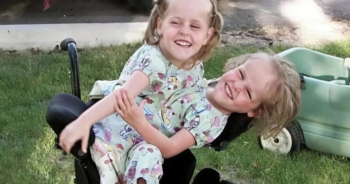 Do You Recall The Combined Sisters Born In 2002? These Sisters Were ...