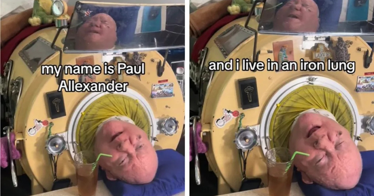 Inspirational People: Remembering Paul Alexander, One Of The Last Polio ...