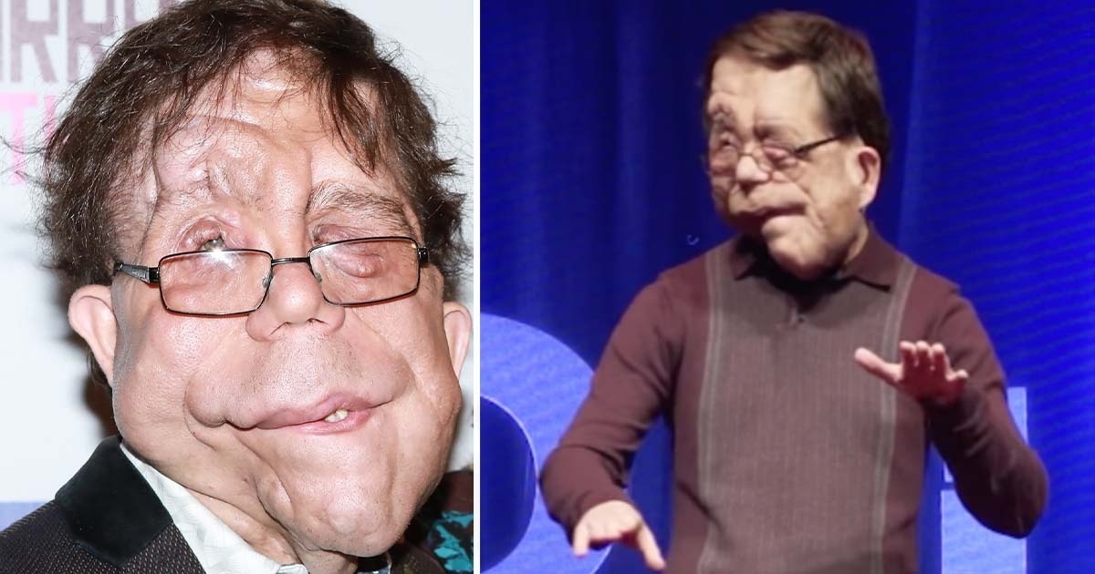 The incredible story of actor Adam Pearson: He’s an inspiration to ...