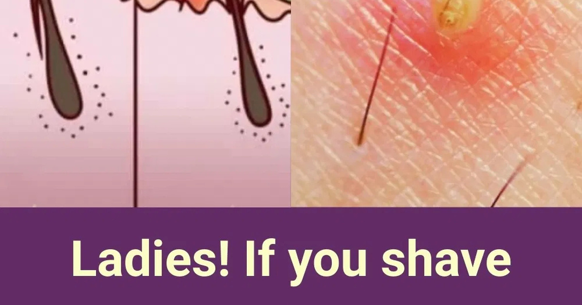 Ladies! If you shave your public hair, read this! - Yohanpost