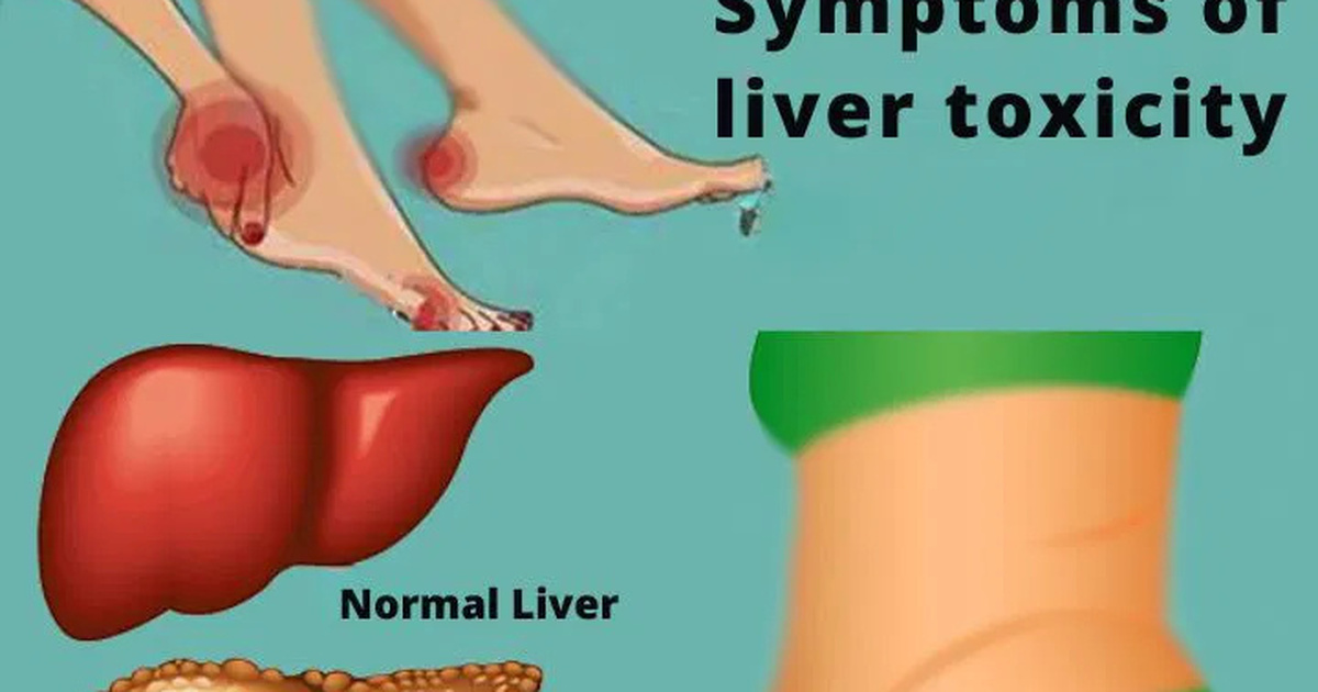 11 Signs Your Liver Is Not Working Well and Toxins Are Building Up in ...