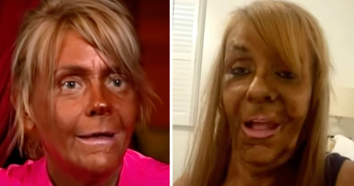 How Patricia Krentcil, “Tan Mom”, looks like today - Yohanpost