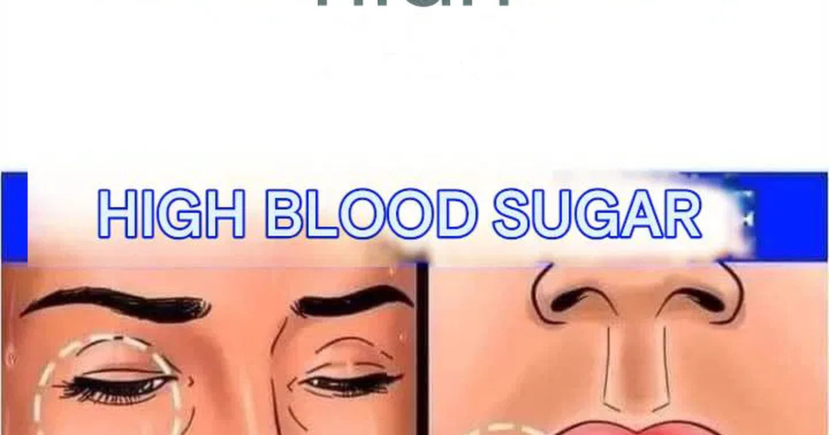 12 Signs Your Blood Sugar is Too High - Yohanpost