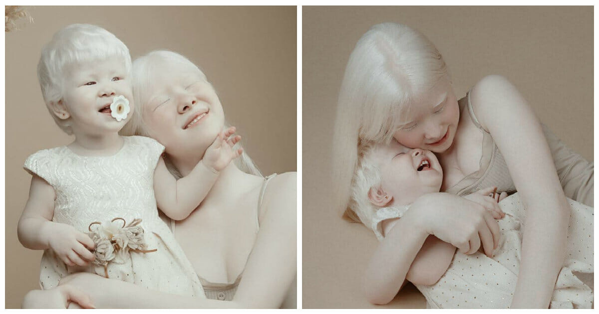 Albino sisters born 12 years apart become modeling sensations - Yohanpost